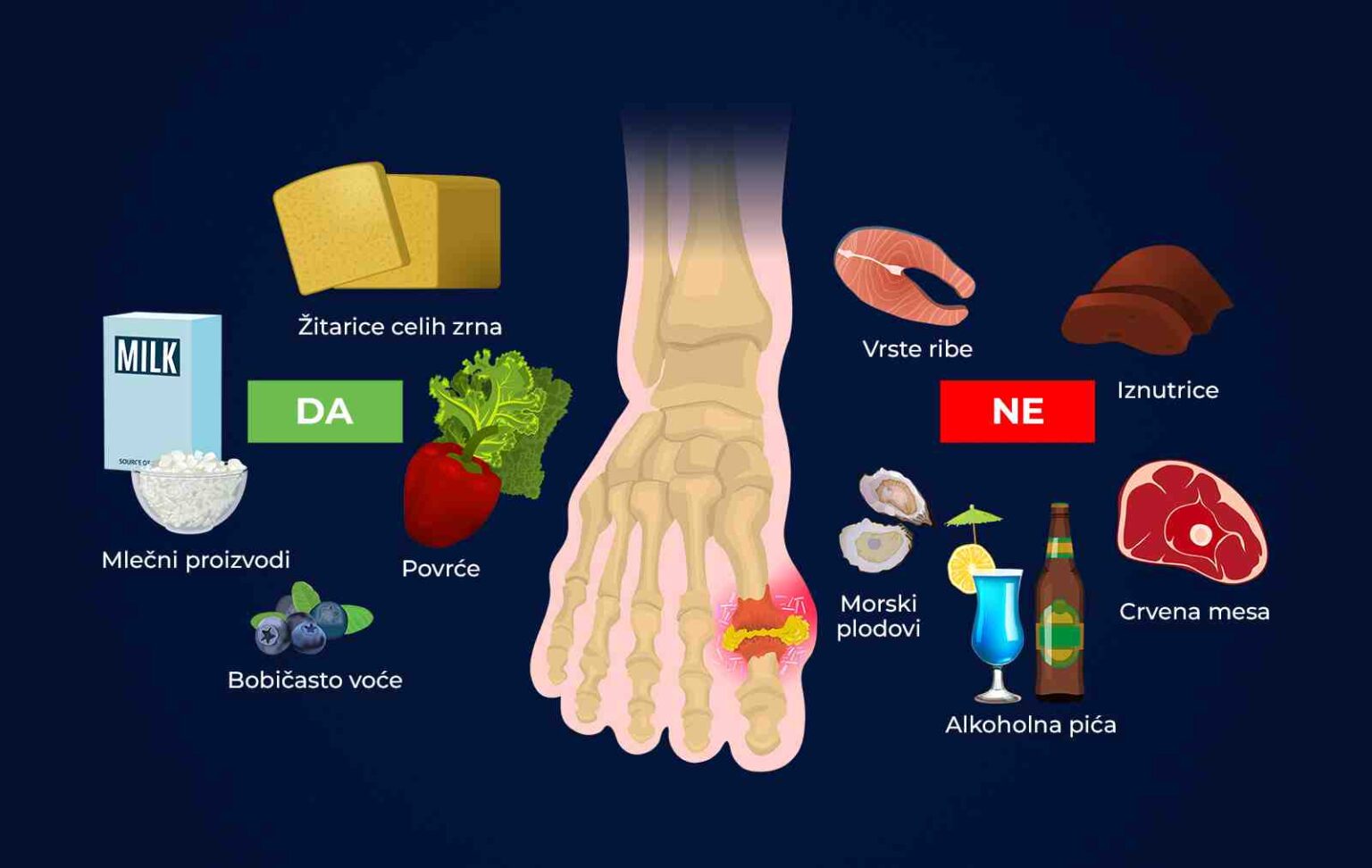 Najčešći uzroci oboljenja od gihta – bolest bogatih namirnica i ...